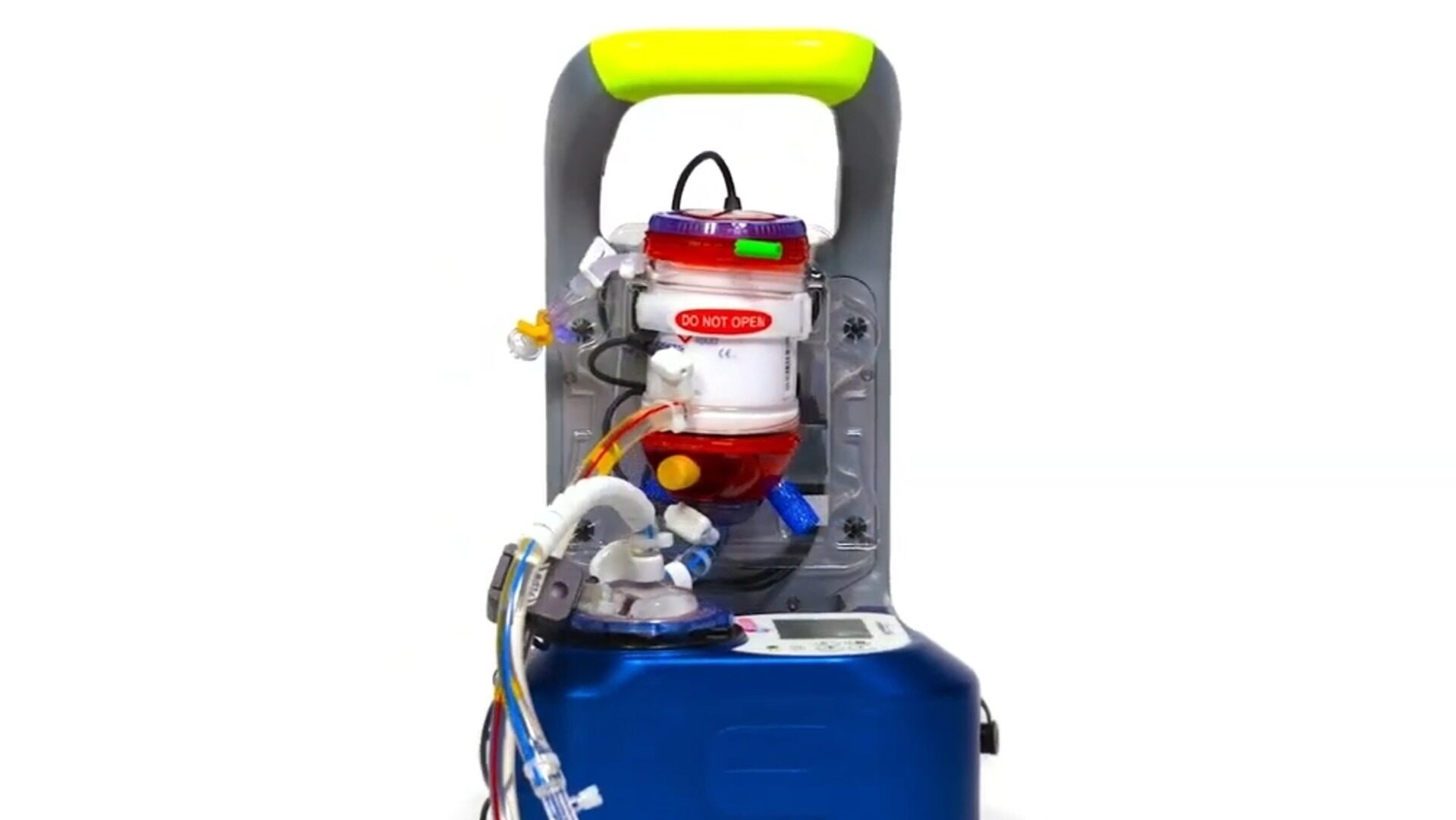 Building an Extracorporeal Cardiopulmonary Resuscitation Program at a ...