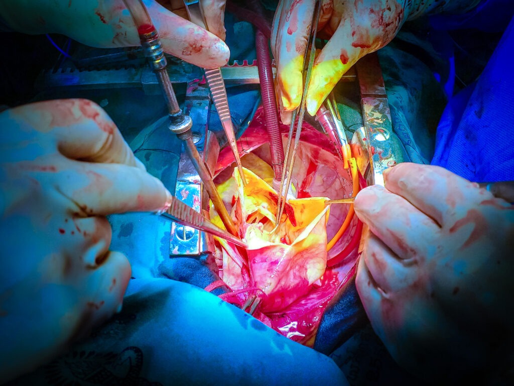 Missions International Perfusion Association